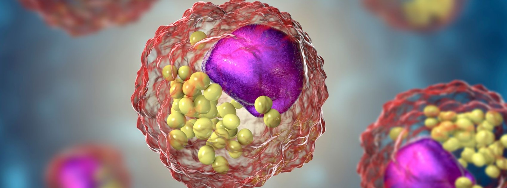 5 Causes Of High LDL Bad Cholesterol Step One Foods Step One Foods 5-causes-of-high-ldl-bad-cholesterol-step-one-foods-step-one-foods